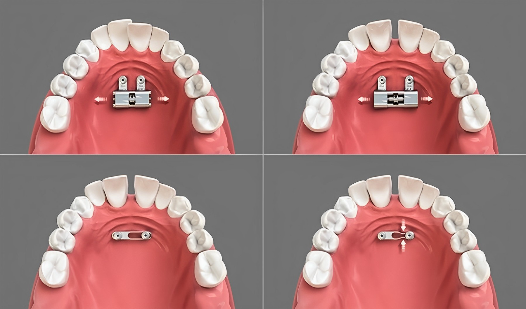 Kieferorthopädische Operationen | MKG Wellingdorf